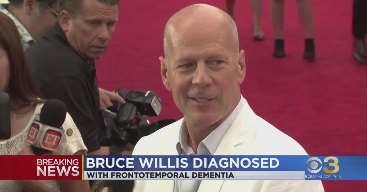 Bruce Willis diagnosed with frontotemporal dementia - CBS Philadelphia Bruce Willis diagnosed with frontotemporal dementia - CBS Philadelphia