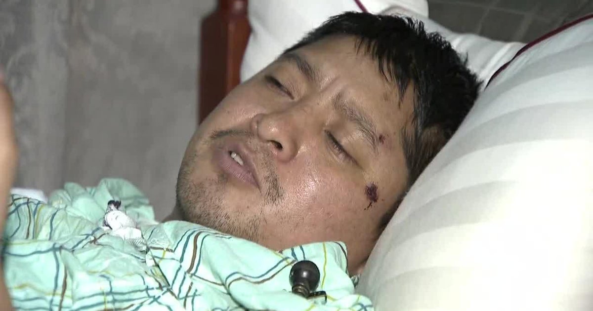 U Haul Truck Rampage Victim Speaks To Cbs2 Cbs New York