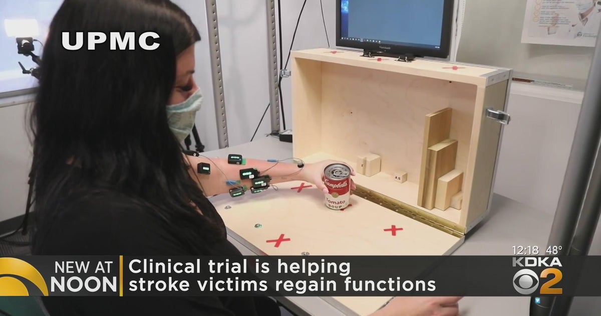 Clinical trial helping stroke victims regain functions - CBS Pittsburgh