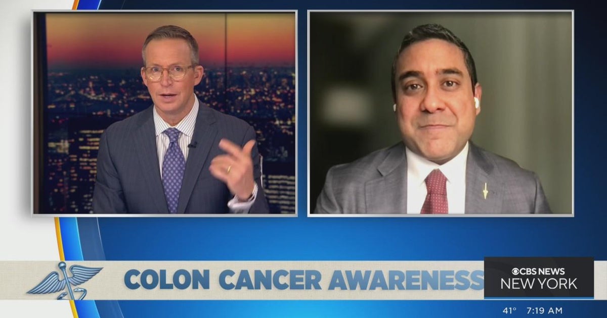 American Cancer Society finds more young people diagnosed with colon ...