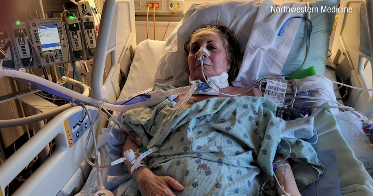 "Am I dreaming?": Double lung transplants save Minnesota woman with ...