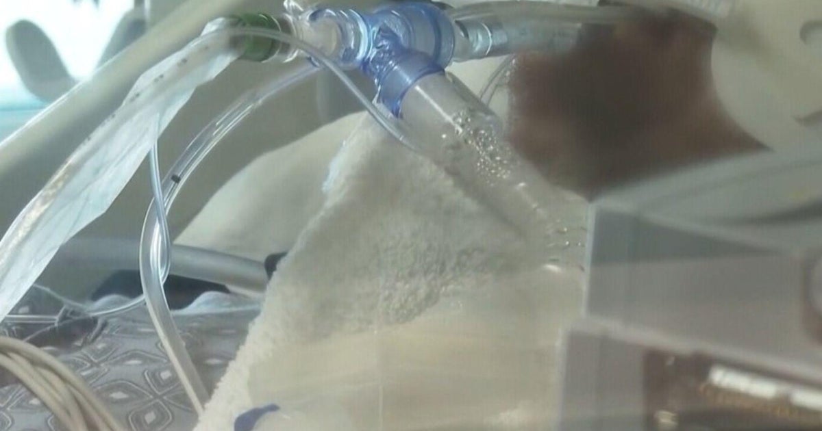 UMMC doctor touts remarkable progress in pandemic fight but 'COVID is ...