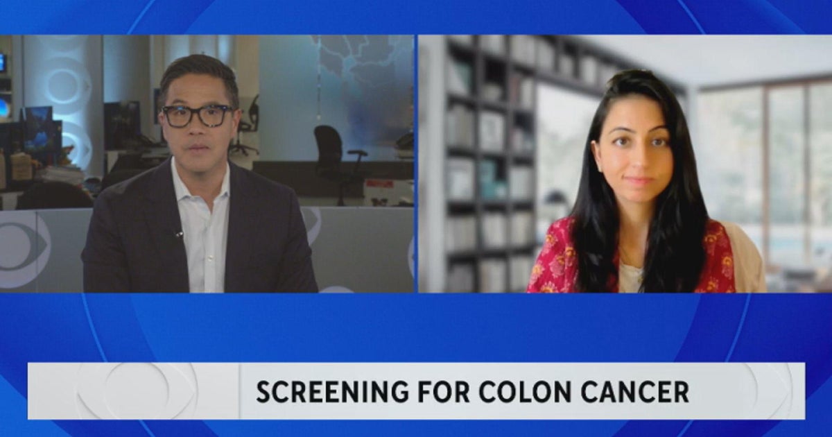 Colon cancer cases rising in young adults - CBS San Francisco