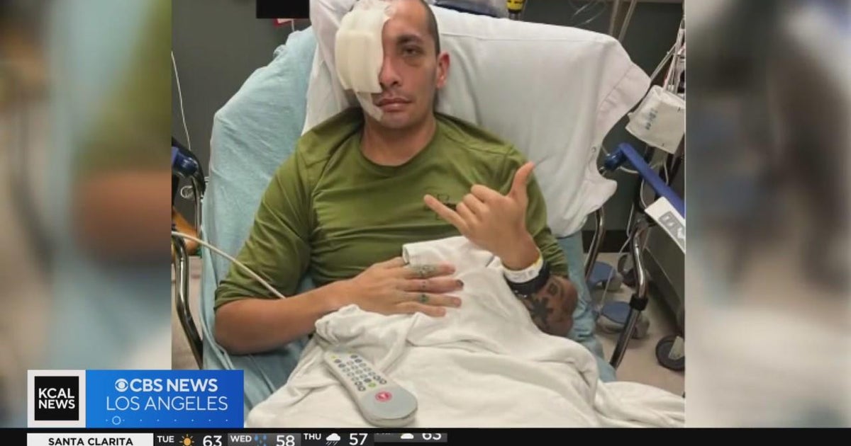 Veteran wounded while volunteering in Ukraine returns home to Orange ...