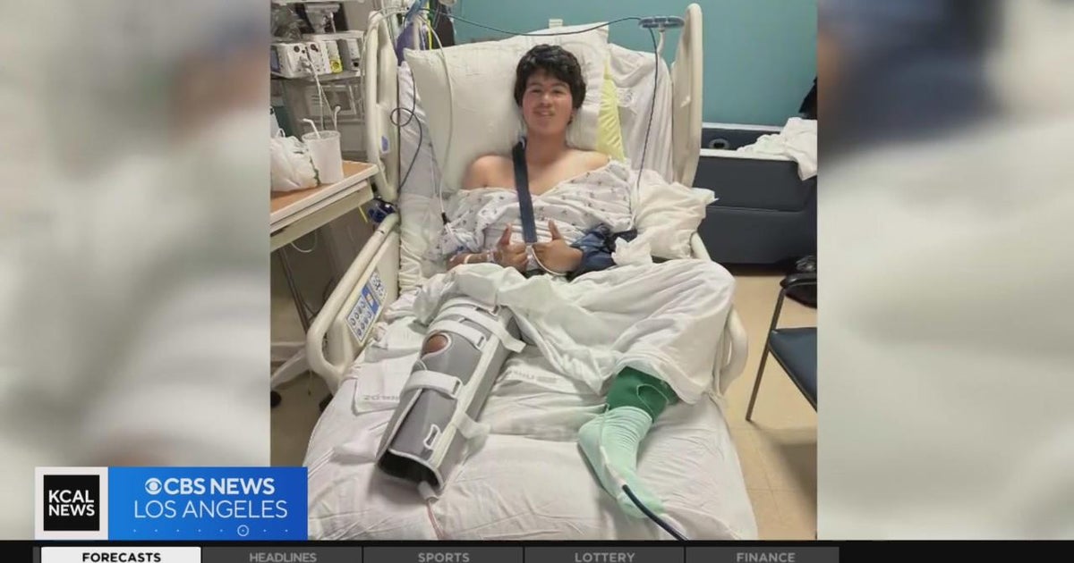 13-year-old who lost his leg during hit-and-run speaks out - CBS Los ...