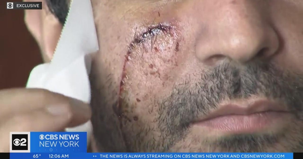 Exclusive: Manhattan gas station worker says he was slashed in face ...