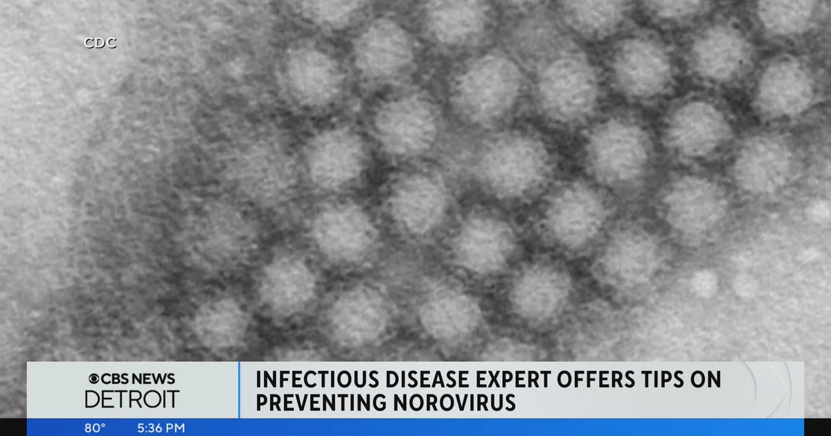 MRLA offering free norovirus clean-up kits to restaurants - CBS Detroit