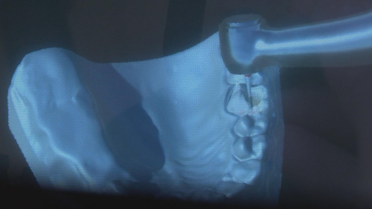Temple University unveils new digital lab for its dental school - CBS ...