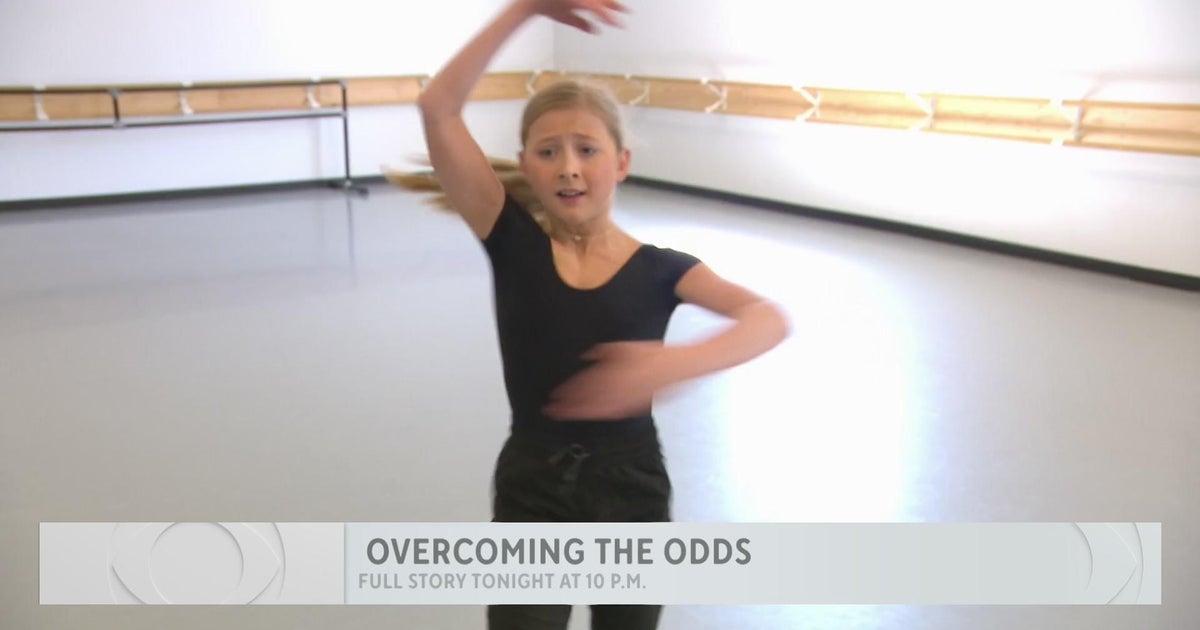 Minnesota dancer defies medical odds - CBS Minnesota