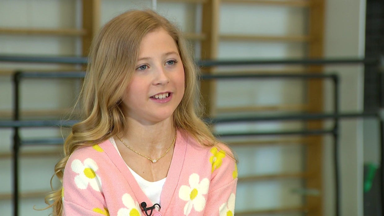 Born with congenital heart defect, 12-year-old Maplewood dancer defies ...