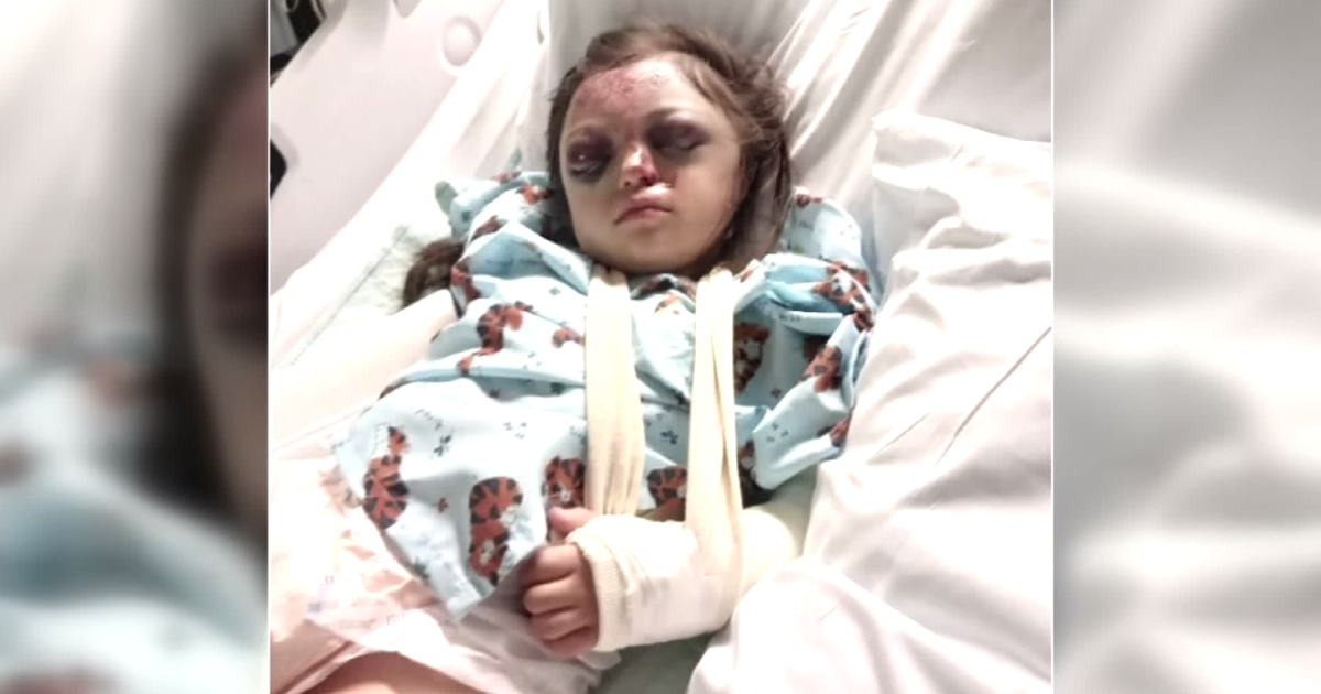 Girl, 6, hit by car in Franklin Park; demand for stop sign - CBS Chicago