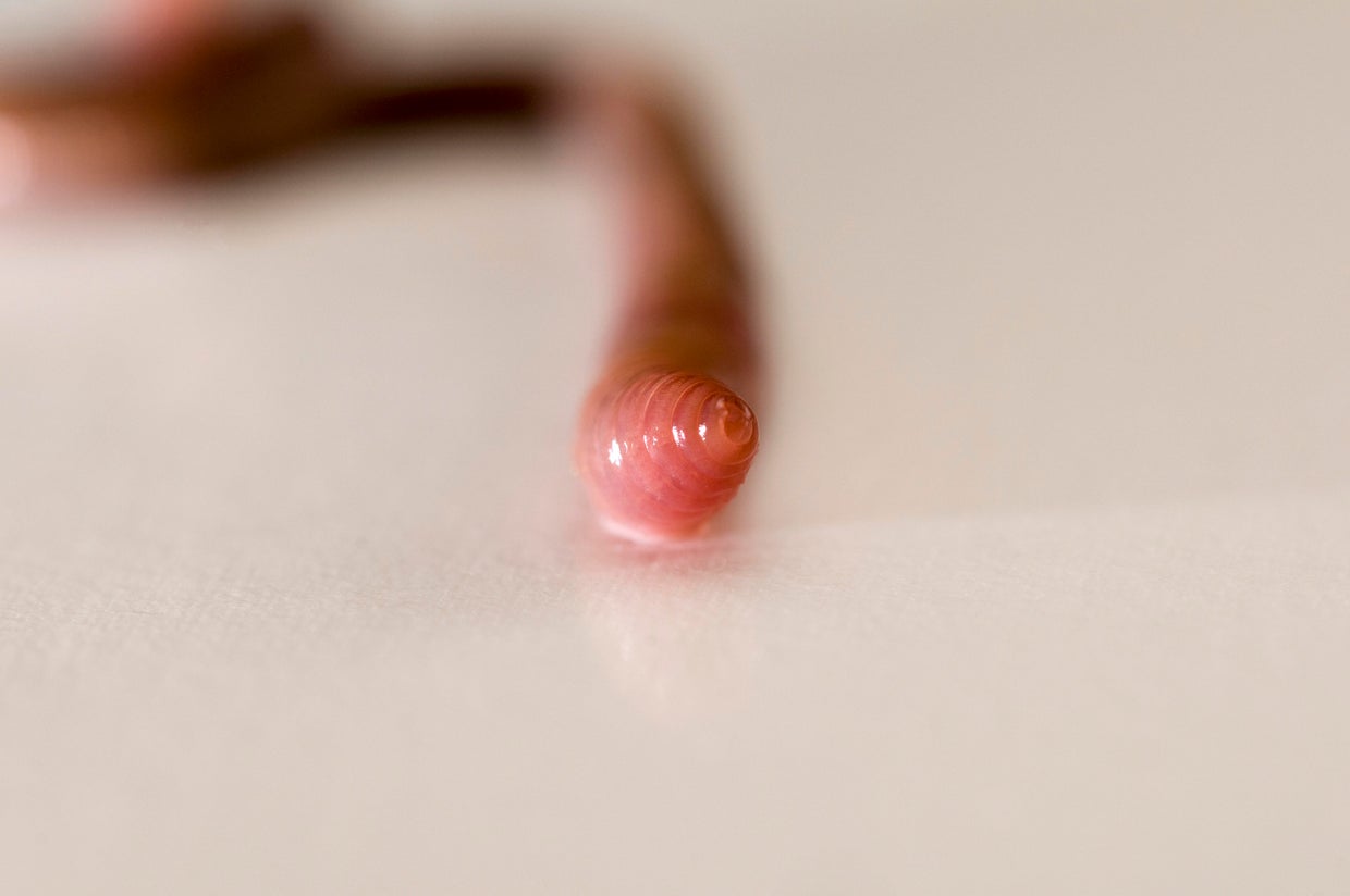 All Minnesota worms are invasive, but which ones do you need to worry ...