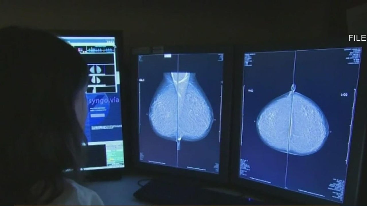 Breast Cancer news - Today’s latest updates - CBS Sacramento