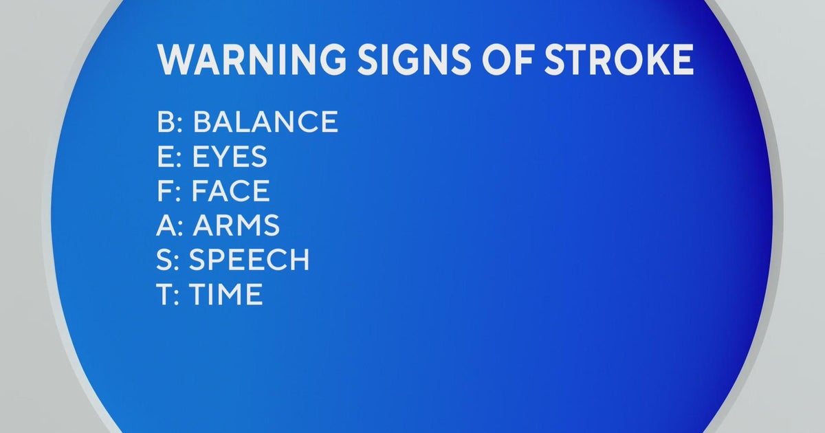 It's important for everyone to know the signs of a stroke - CBS Colorado