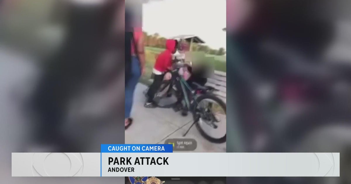Child captured on camera getting attacked at park - CBS Minnesota