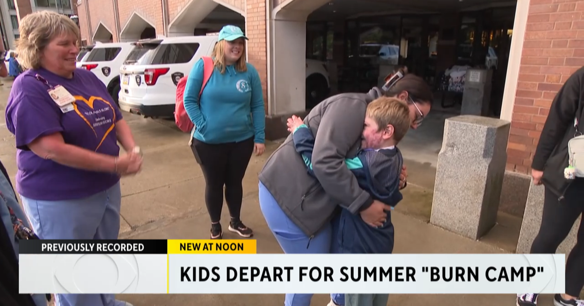 'Burn Camp' provides children with fun, life skills, and lifelong ...