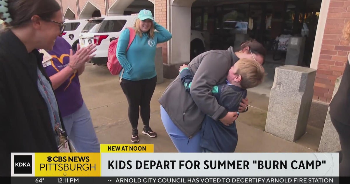 'Burn Camp' provides children with fun, life skills, and lifelong ...