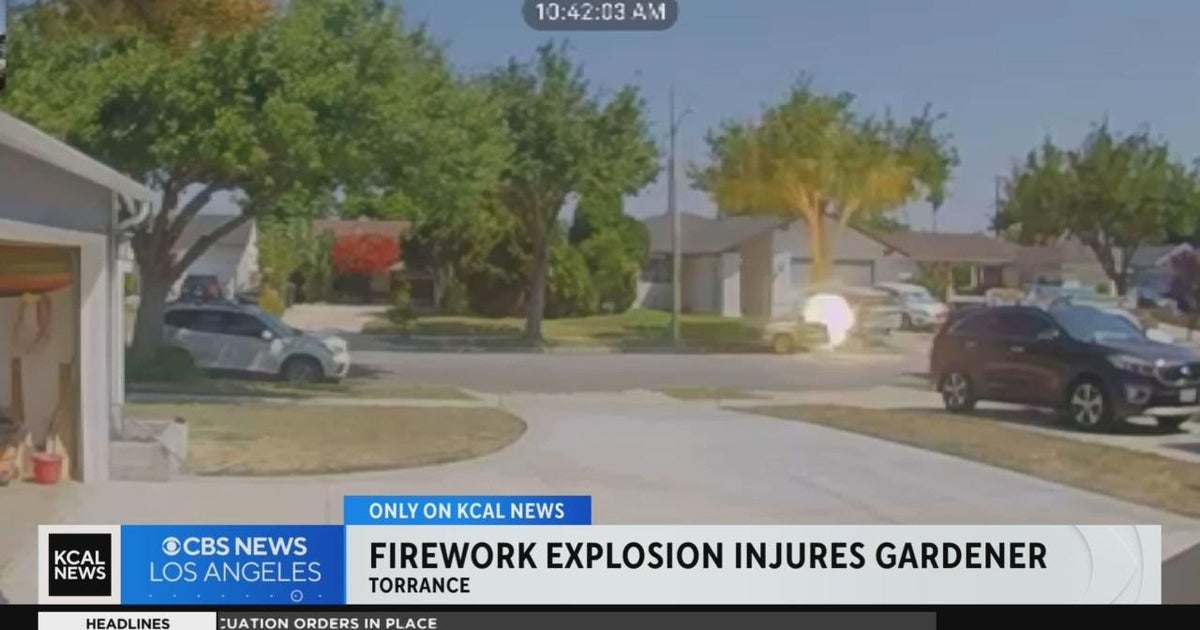 Gardener loses fingers, portion of vision after leftover firework ...