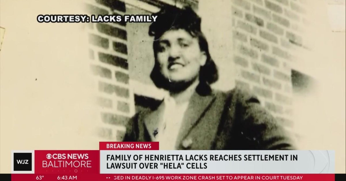 Henrietta Lacks' family reaches settlement over immortal 'HeLa cells ...