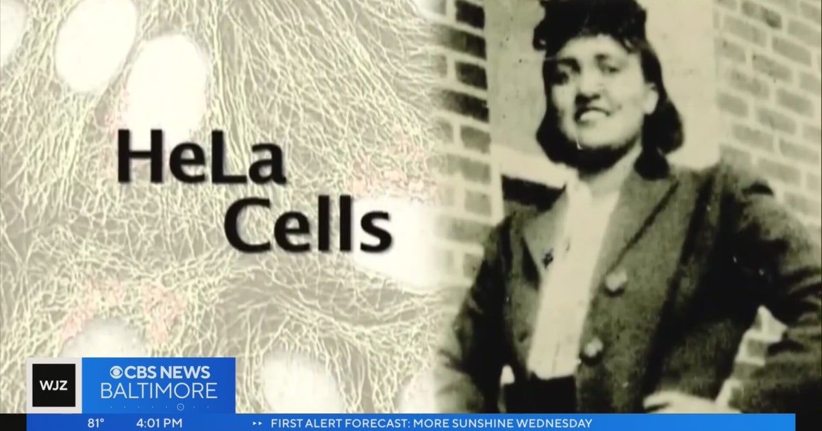 Historic Henrietta Lacks settlement paves the way for 'unjust ...