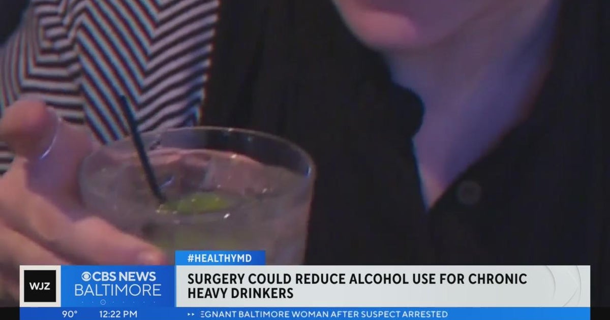 HealthWatch: Surgery could reduce alcohol use for chronic heavy ...