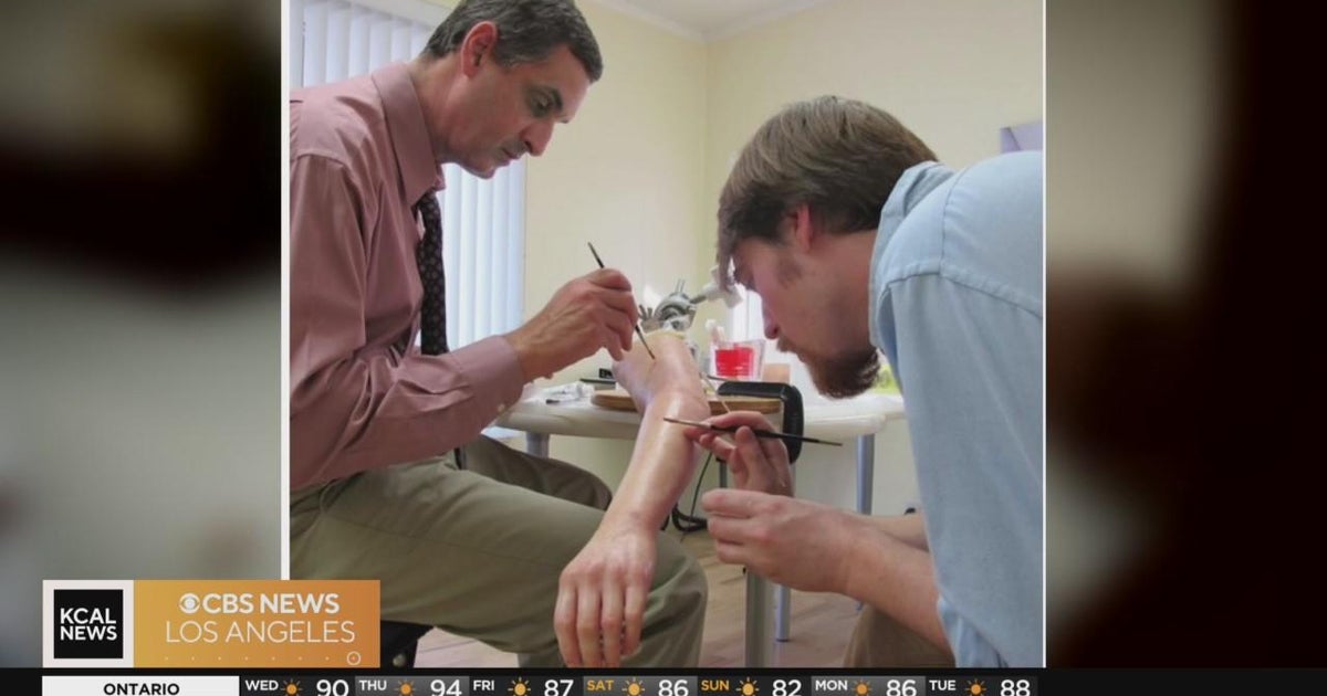 Dr. Stefan Knauss, a certified Prosthetist Anaplastologist - CBS Los ...