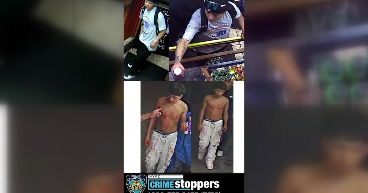 NYPD: 2 teens stabbed with broken beer bottle during robbery attempt at ...