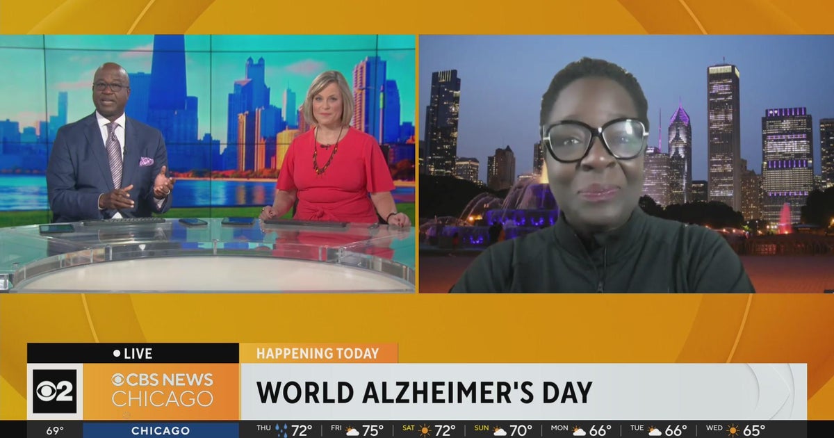 World Alzheimer’s Day: New treatments giving hope to families - CBS Chicago