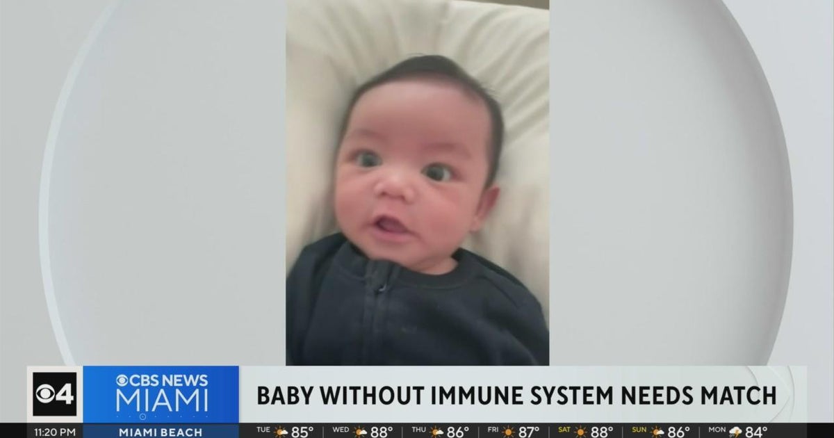 Baby born without immune system needs a match - CBS Miami
