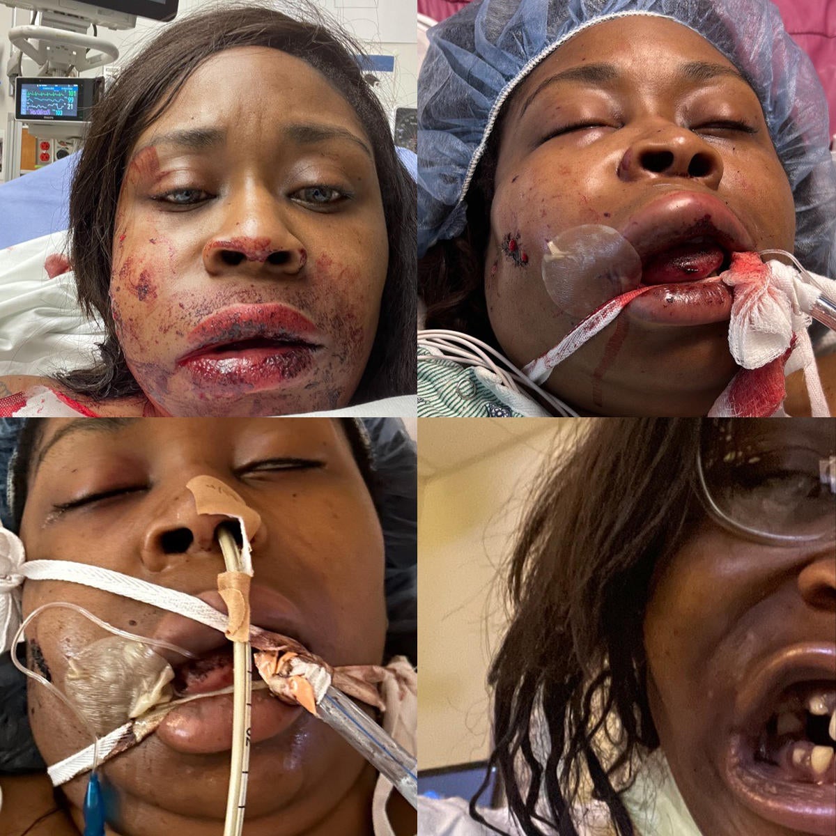 Black women share their frightening experiences being targets of crime ...