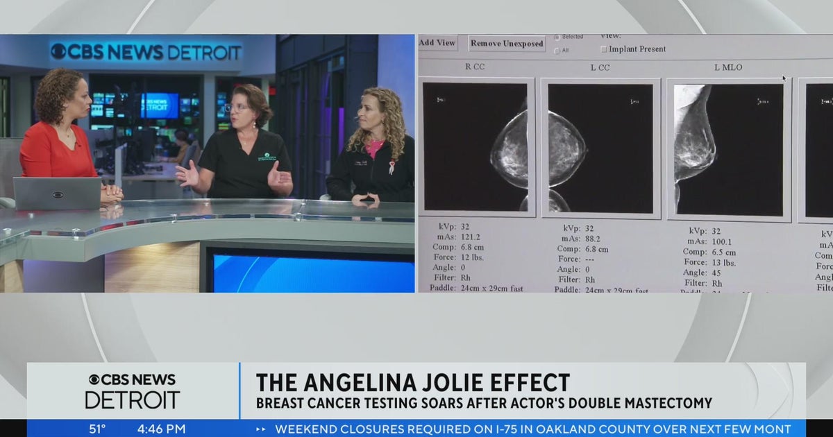Doctors discuss the "Angelina Jolie" Effect - CBS Detroit