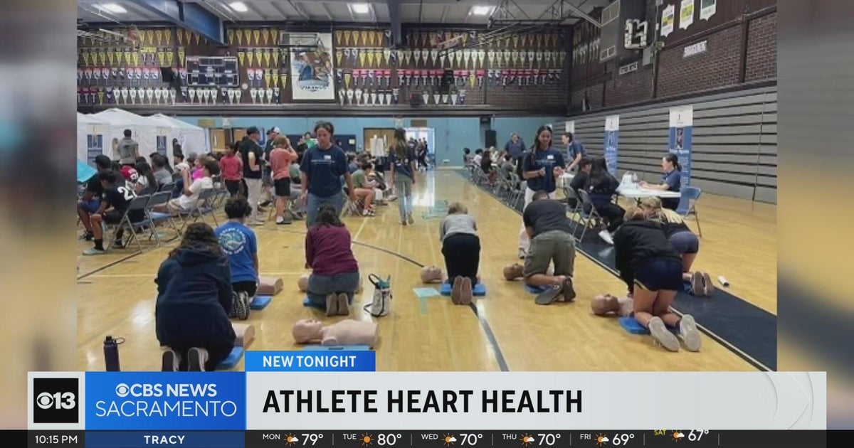 New screenings for athlete heart health - CBS Sacramento