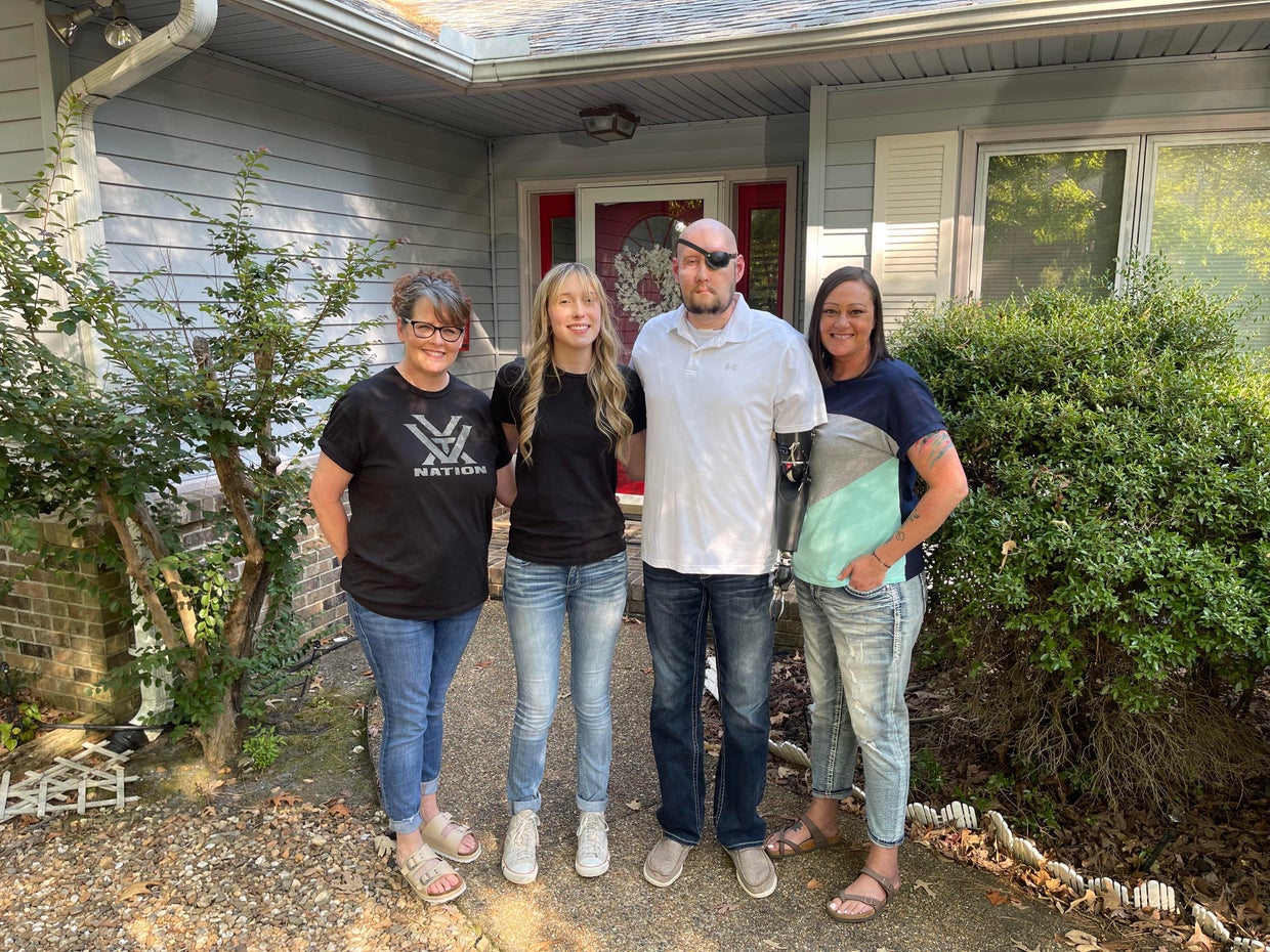 Man who narrowly survived electrical accident receives world's first ...