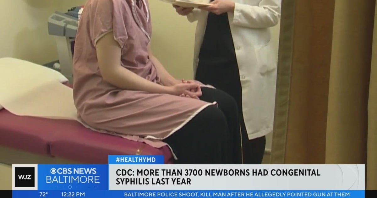 HealthWatch: CDC: More than 3700 newborns had congenital syphilis last ...