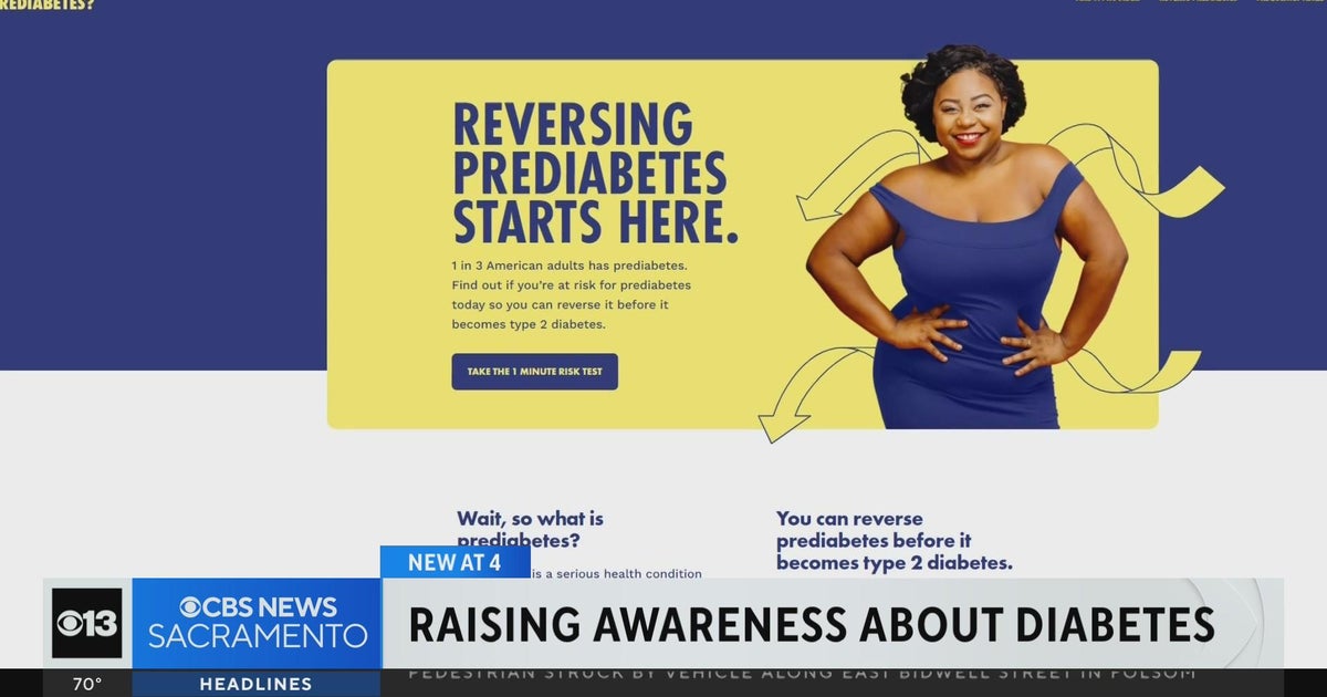 CDC raising awareness about diabetes, prediabetes - CBS Sacramento
