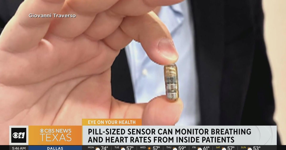 Pill-sized sensor can read patients vitals - CBS Texas