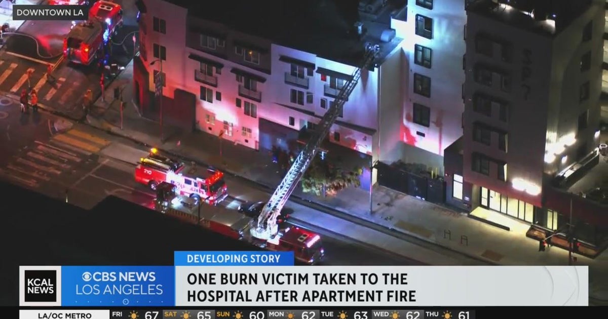Man severely burned in apartment fire in downtown LA - CBS Los Angeles Man severely burned in apartment fire in downtown LA - CBS Los Angeles