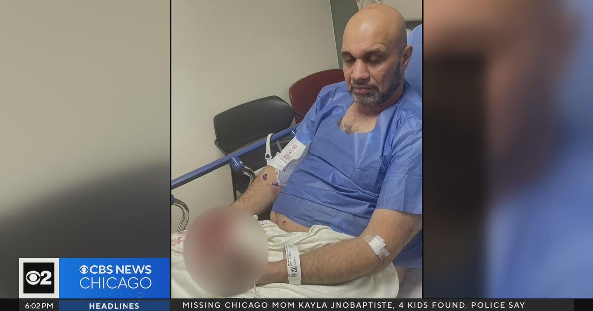 Elgin road rage victim speaks exclusively to CBS 2 - CBS Chicago