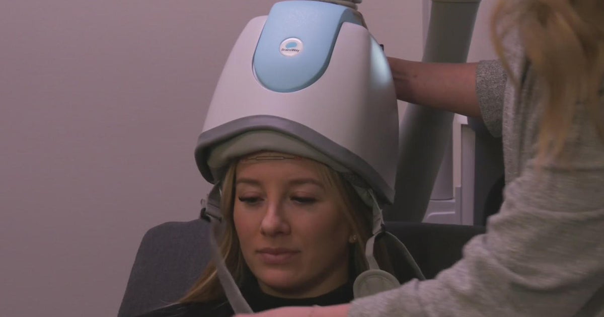 What Is Transcranial Magnetic Stimulation