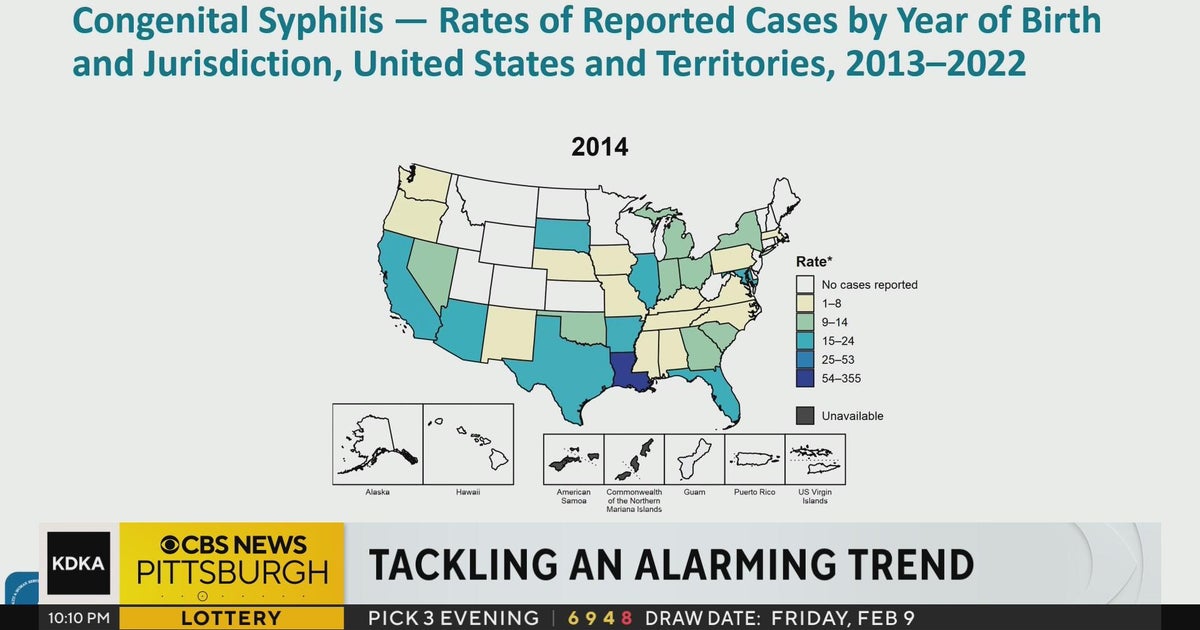Syphilis cases surging nationwide in recent years - CBS Pittsburgh