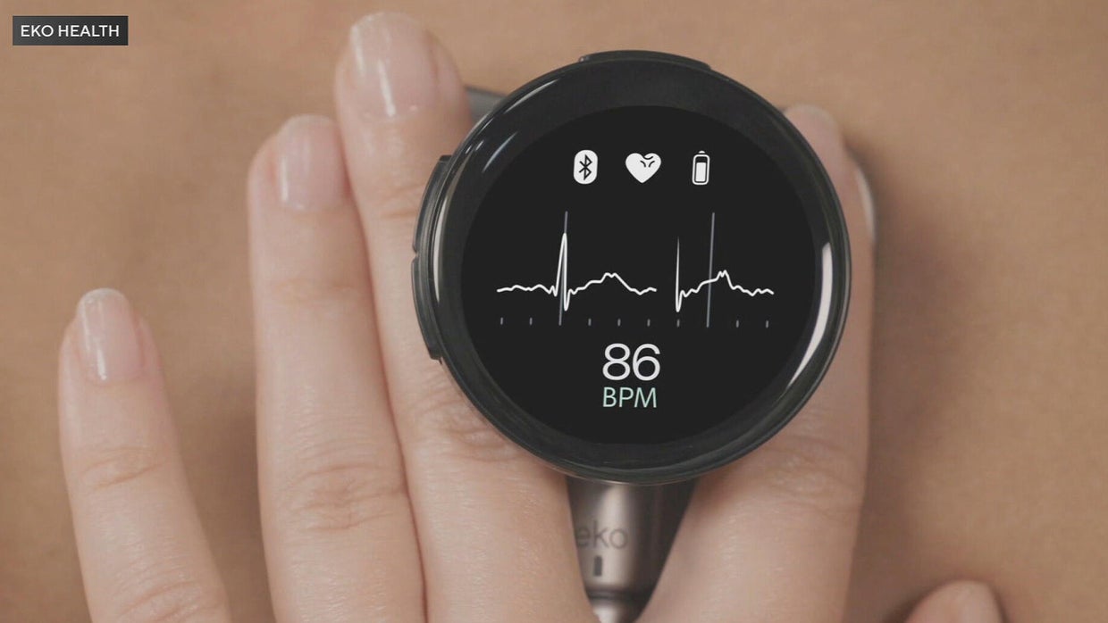 Digital stethoscope uses artificial intelligence to help doctors detect ...