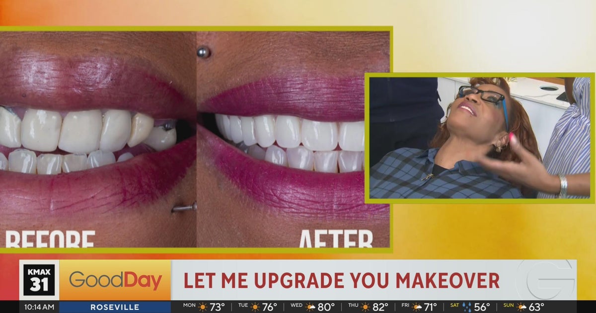 Let Me Upgrade You makeover - a trip to the dentist! - Good Day Sacramento