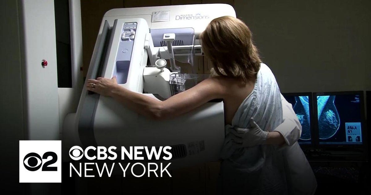 There are new guidelines for how often women should get mammograms ...