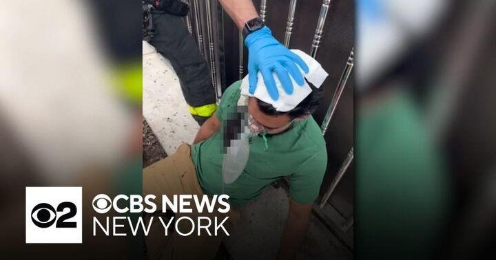 Queens man recounts being stabbed in head outside his home - CBS New York