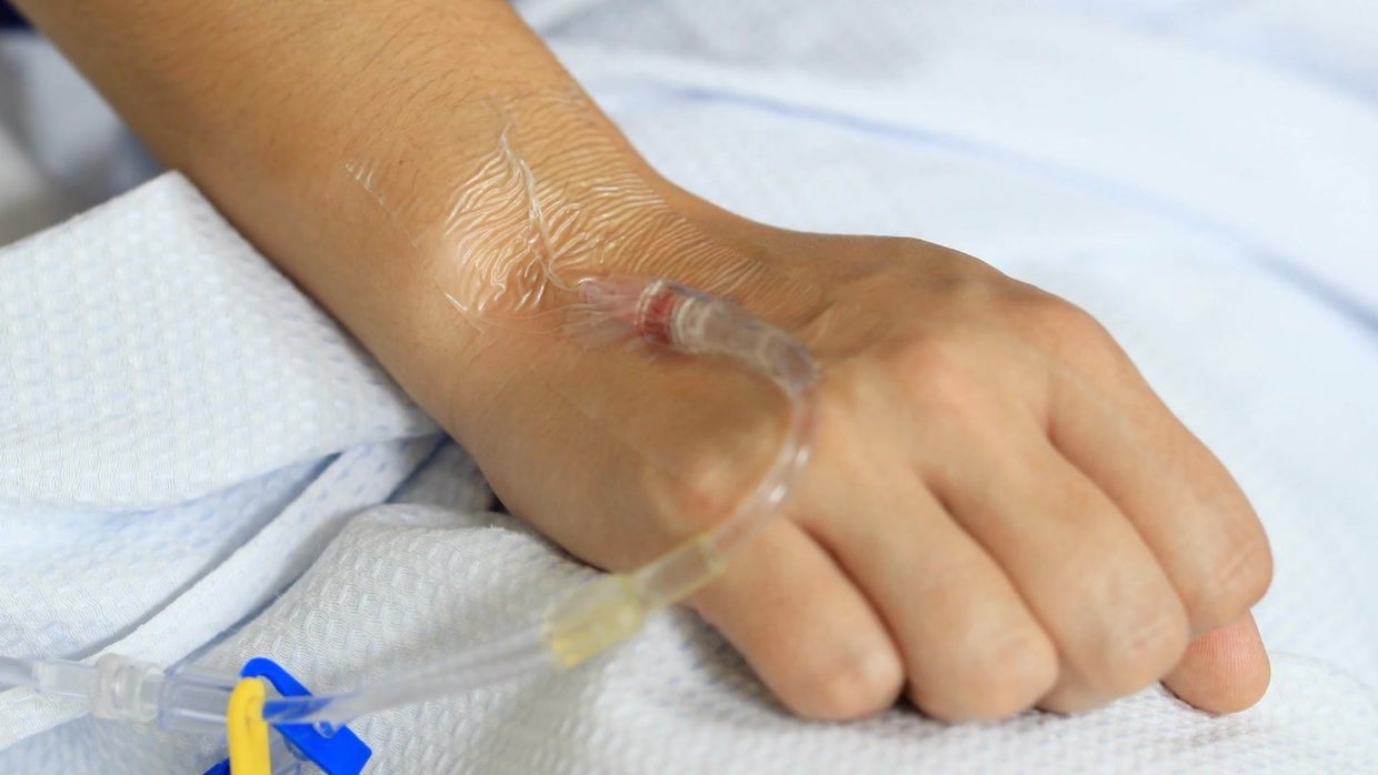 Inflammatory bowel disease cases surging in children and adults ...