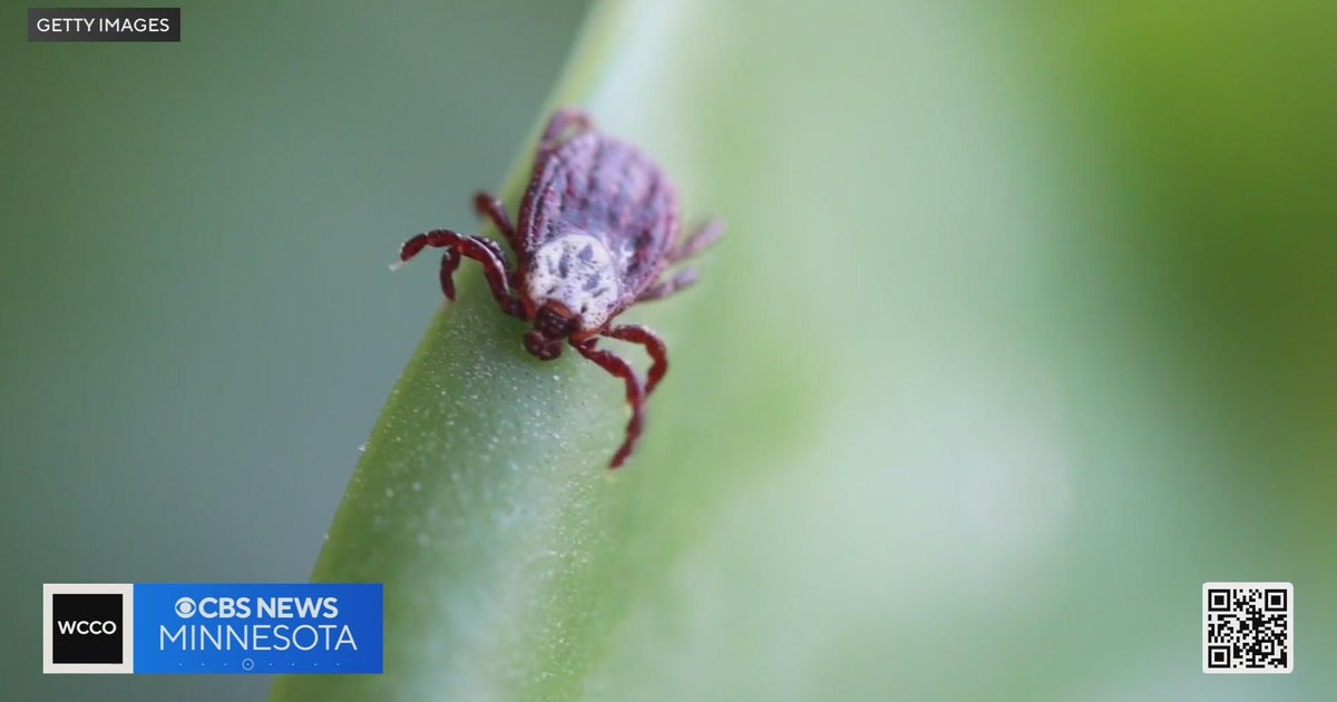 Talking Points preview: The danger of ticks - CBS Minnesota