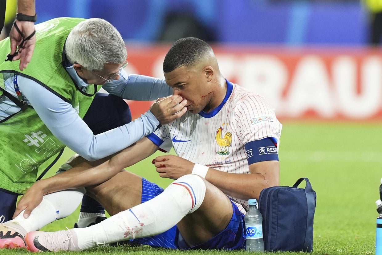 Broken nose to force France's soccer star Kylian Mbappé to wear a mask ...