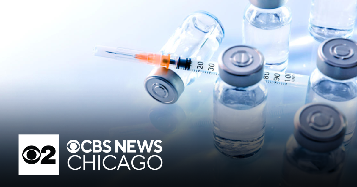 Confirmed case of plague found in Colorado - CBS Chicago