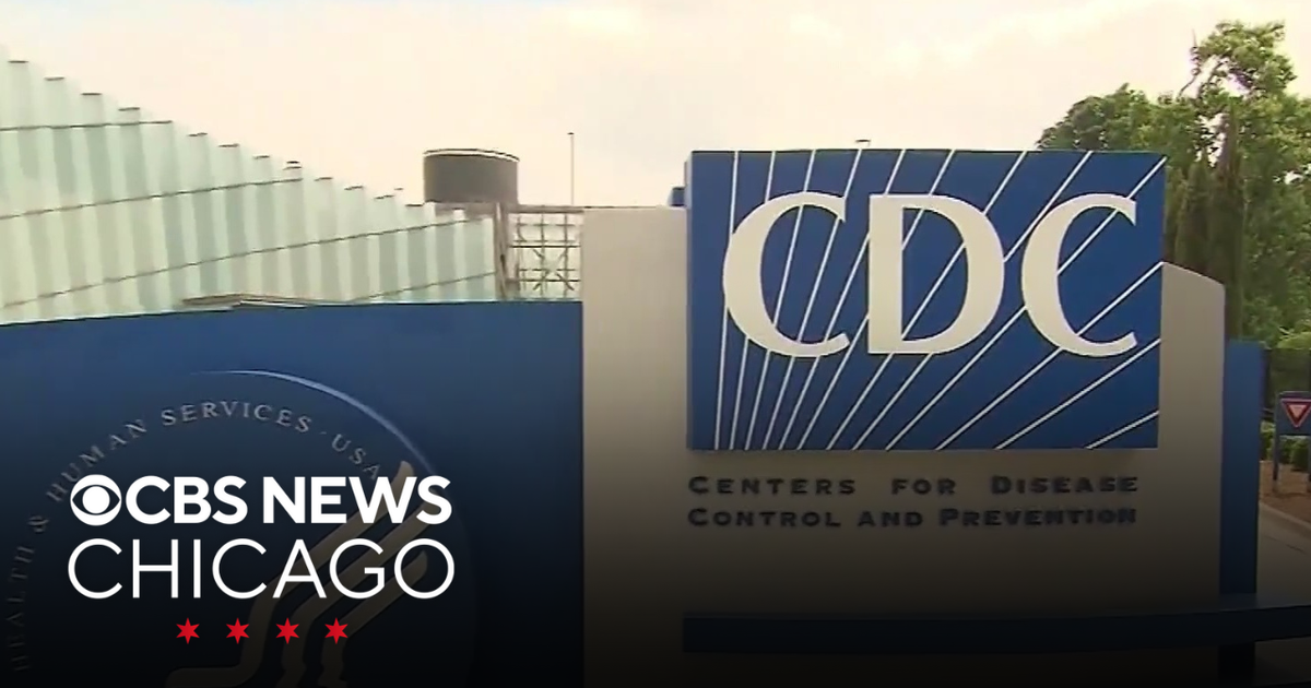 CDC sees increase in whooping cough patients - CBS Chicago