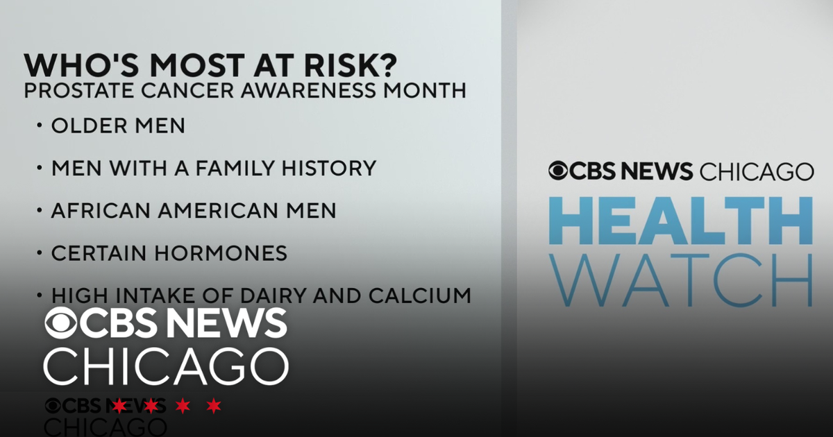 What you need to know during Prostate Cancer Awareness Month - CBS Chicago
